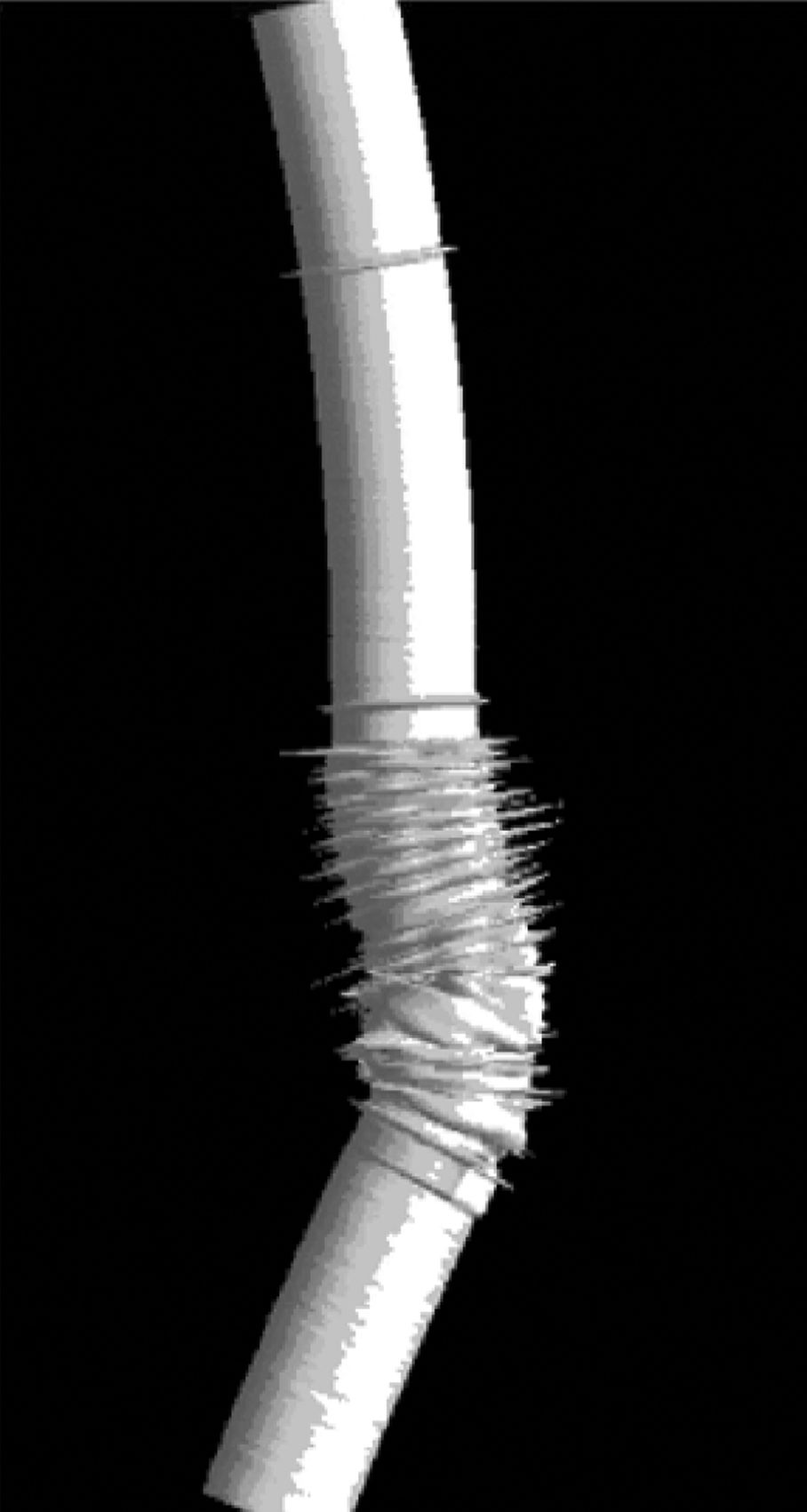 Casing inspection logs | Society of Petroleum Engineers (SPE) | OnePetro